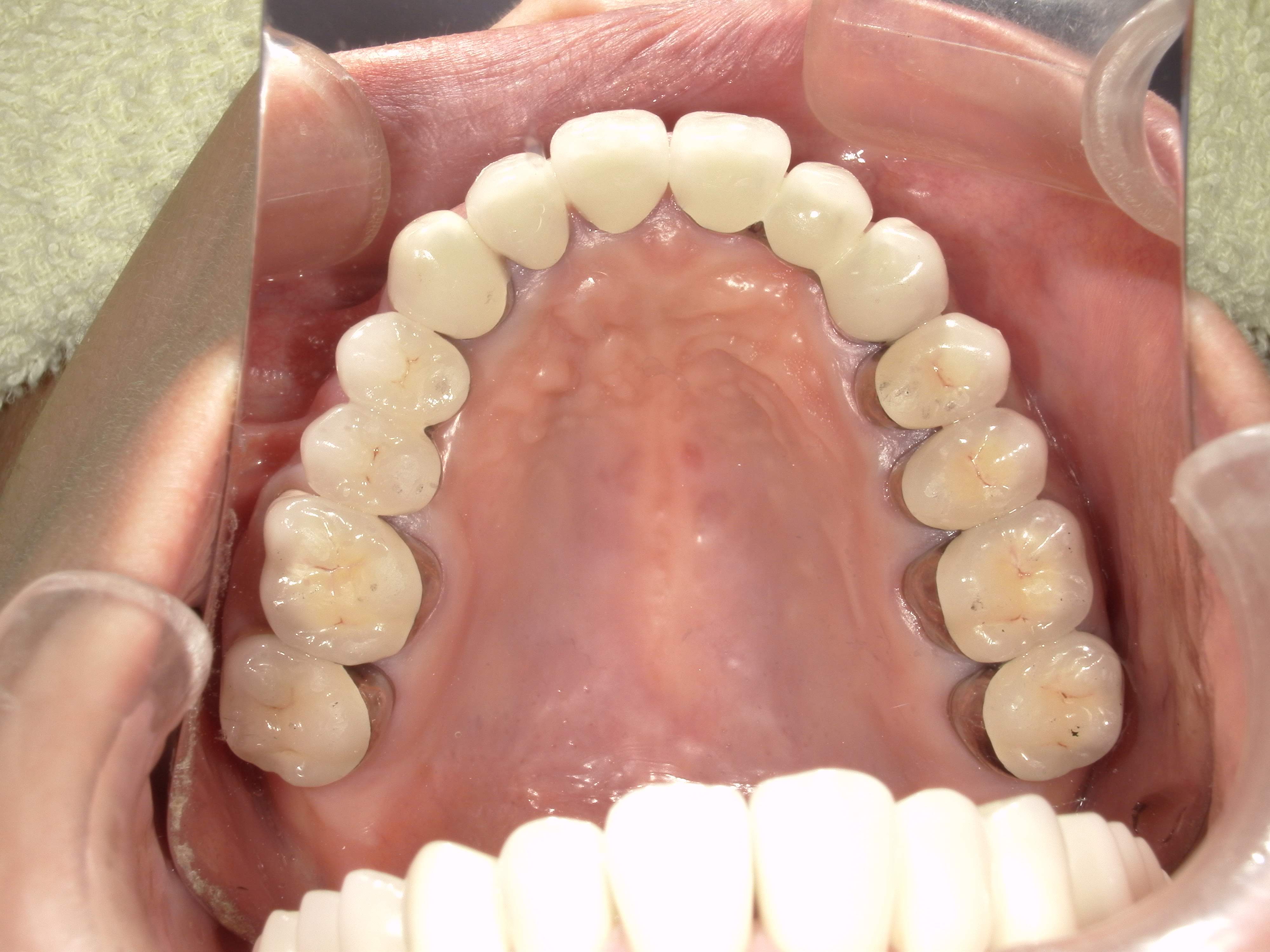 SHOFU DENTAL DIGITAL CAMERA - 香川県高松市 インプラント・根菅治療・歯根破折予防 三枝デンタルオフィス