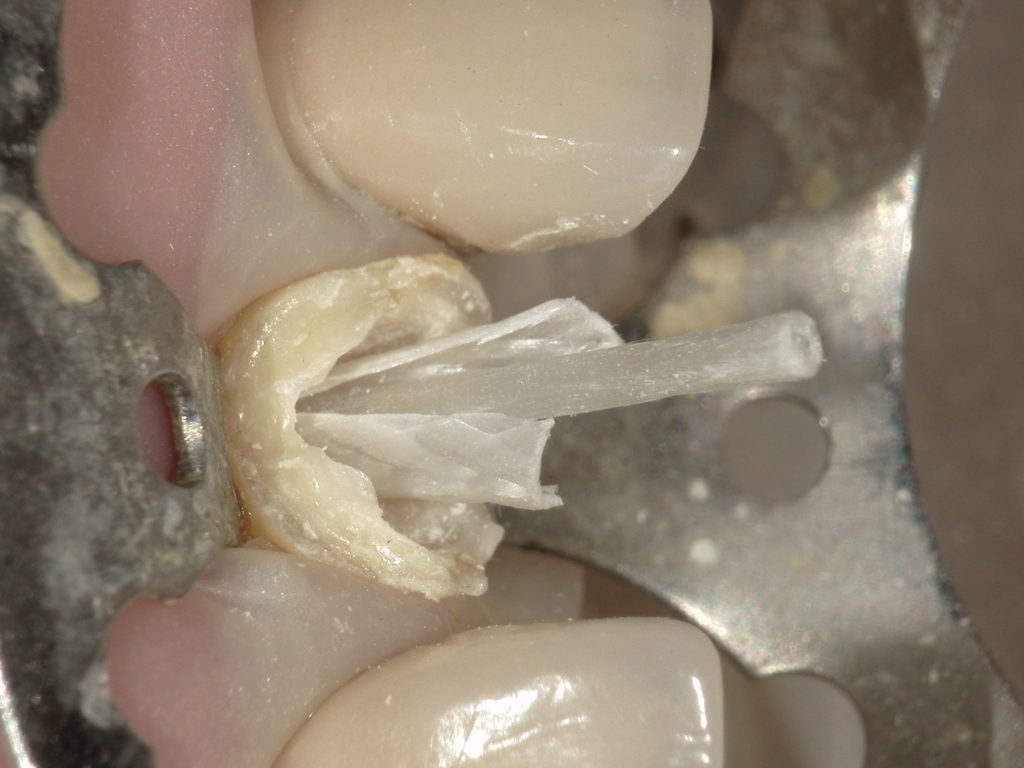 SHOFU DENTAL DIGITAL CAMERA - 香川県高松市 インプラント・根菅治療・歯根破折予防 三枝デンタルオフィス