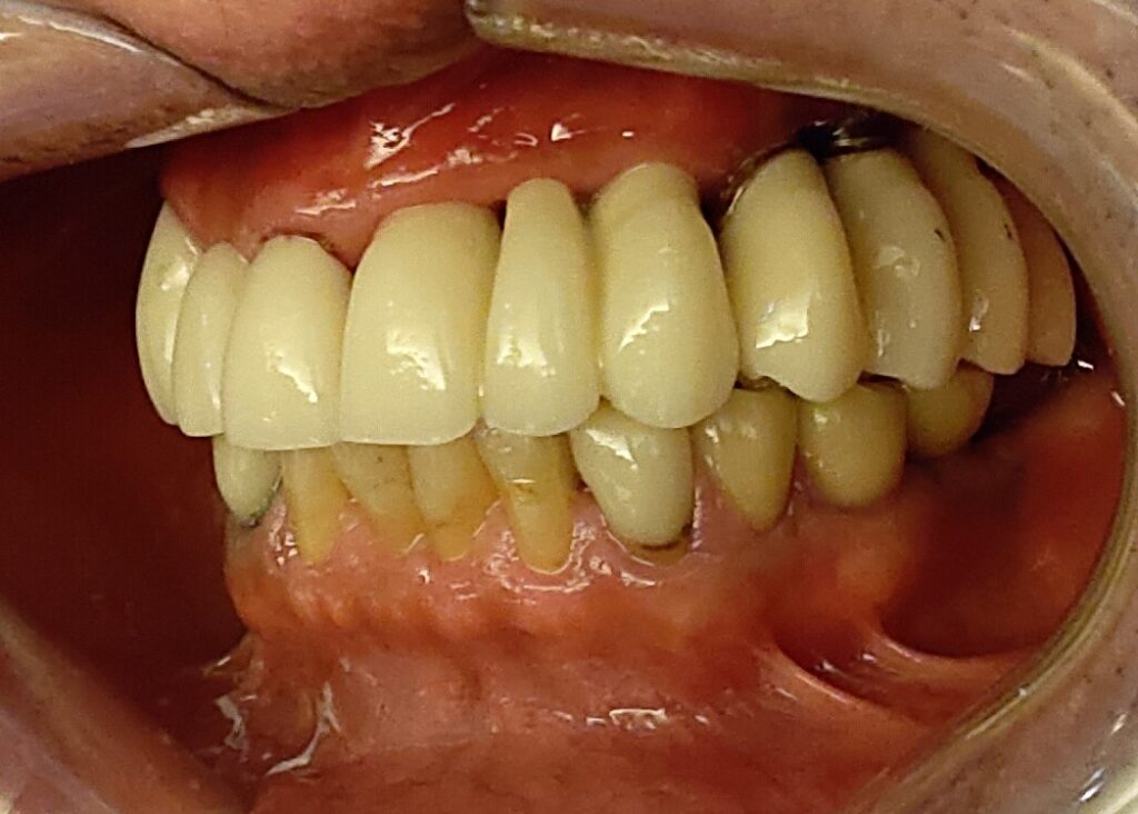 IMG_20220604_162914~2 - 香川県高松市 インプラント・根菅治療・歯根破折予防 三枝デンタルオフィス